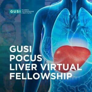 Portal hypertension - Global Ultrasound Institute